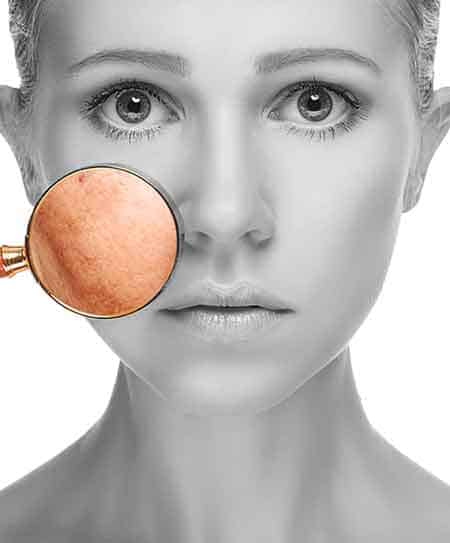 Microneedling Product - Bellair Laser Clinic